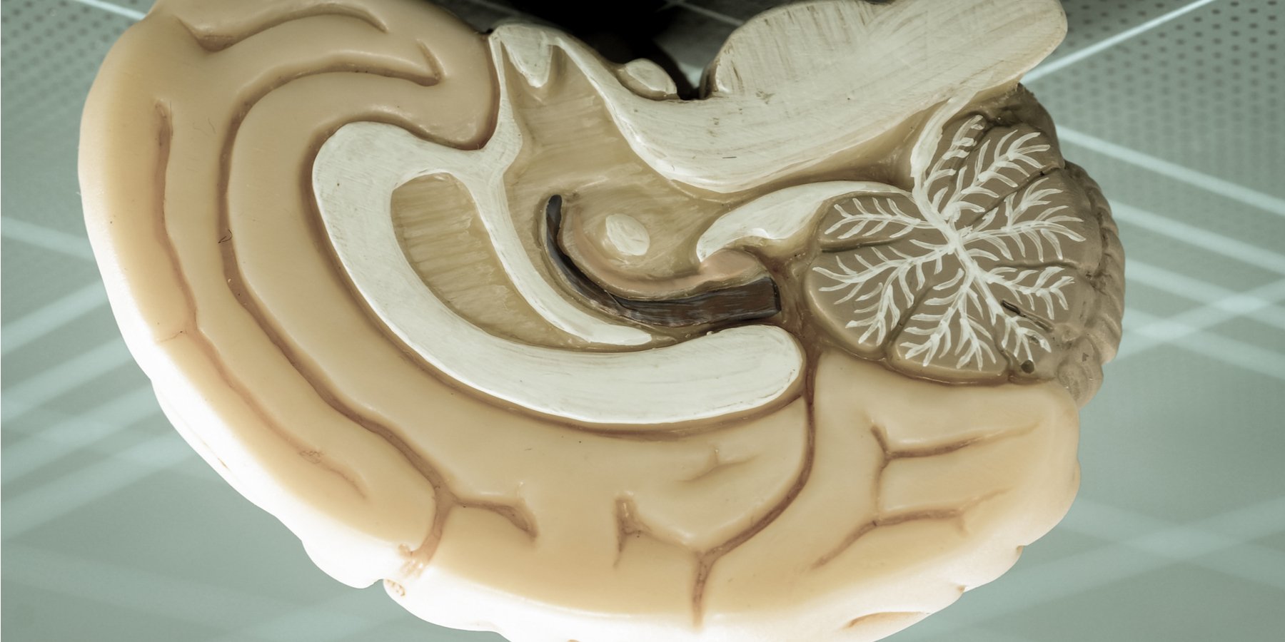 Brain Death: At Once "Well Settled" and "Persistently Unresolved ...