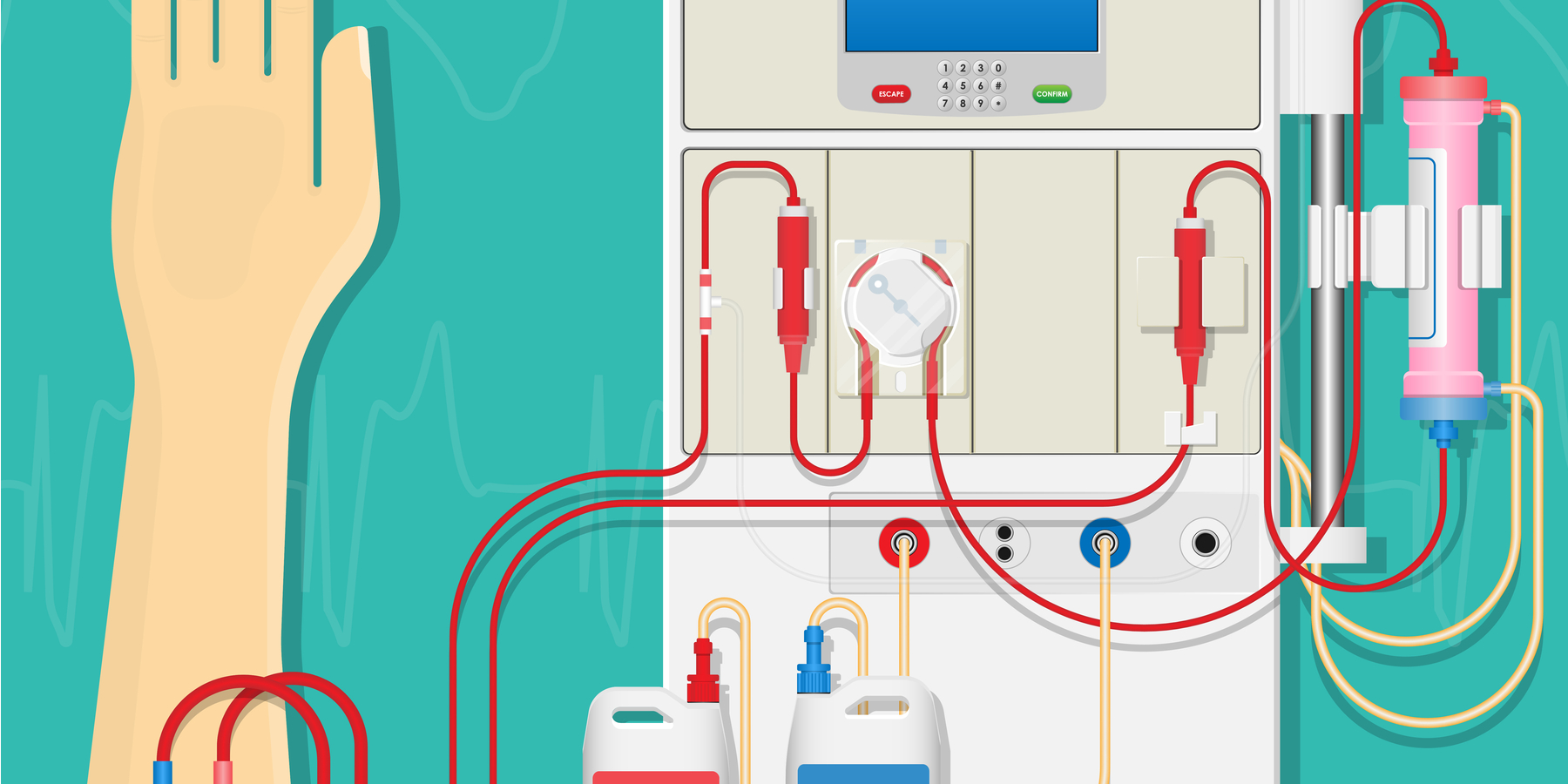 God Panels and the History of Hemodialysis in America: A Cautionary ...