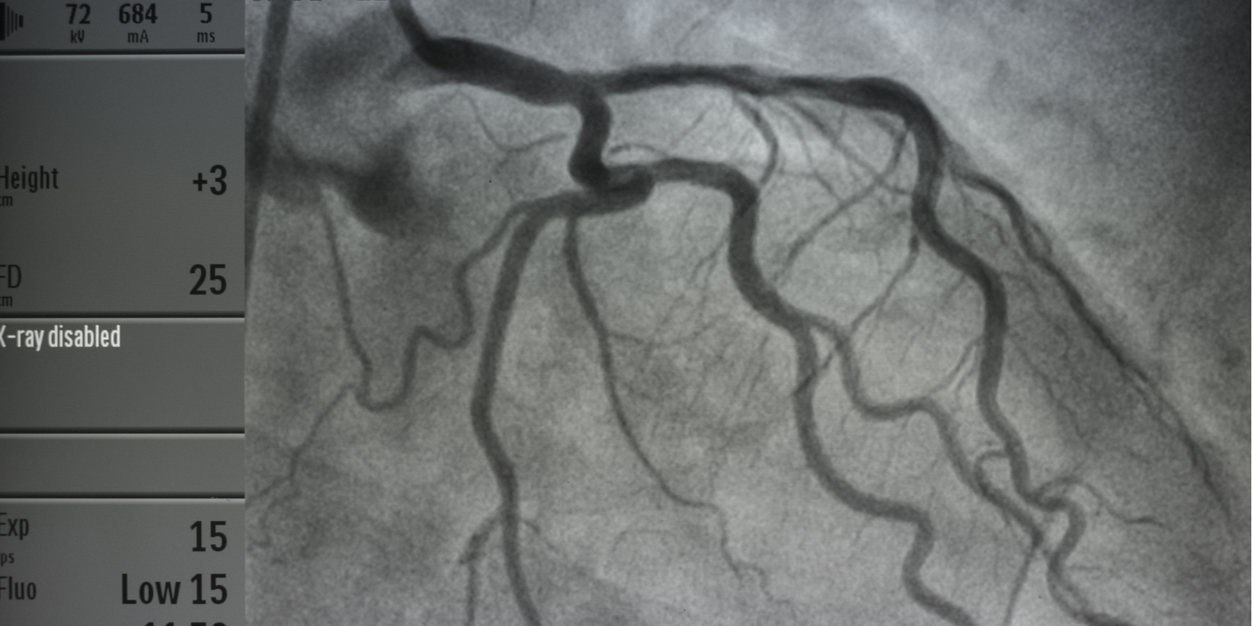 Disclosure and Patient Information: Mr. Douglas's Angiogram Gets a ...