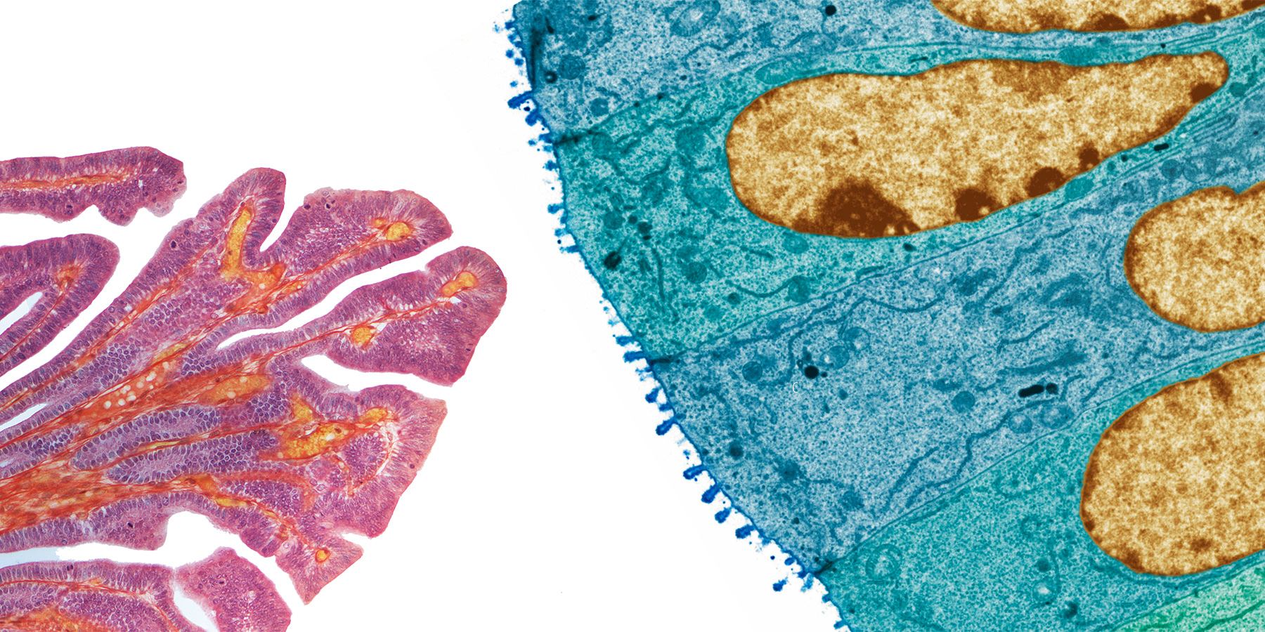 National Organ Allocation Policy: The Final Rule | Journal of Ethics ...