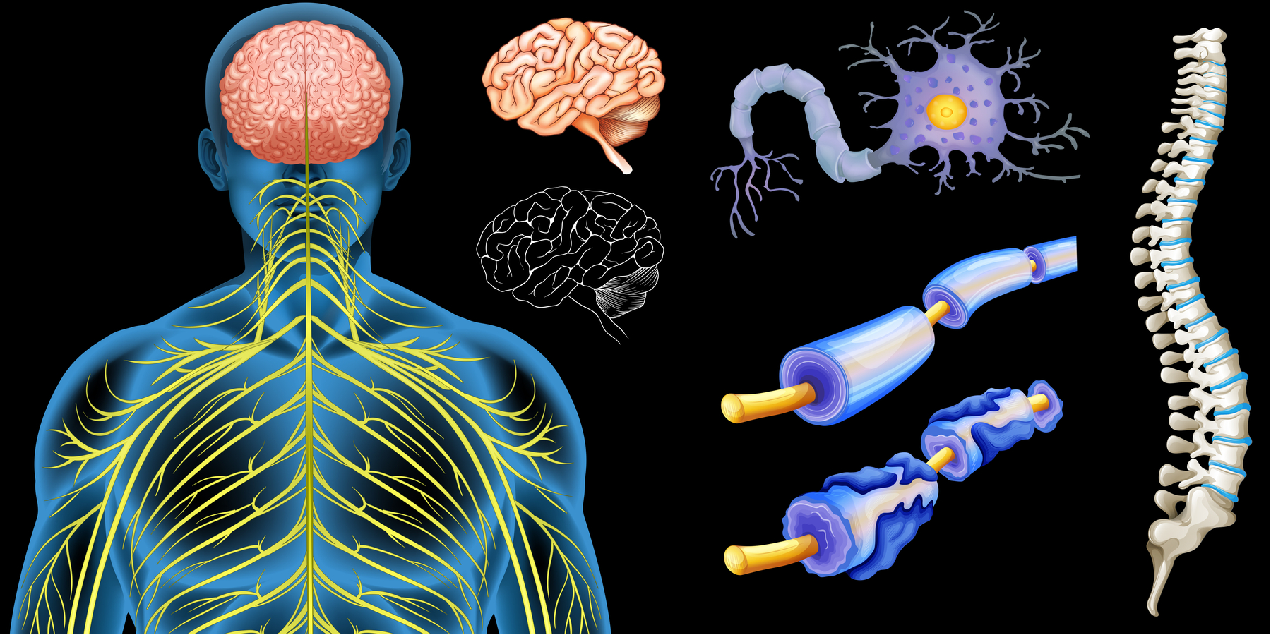 Multiple Sclerosis Carlyn Lind